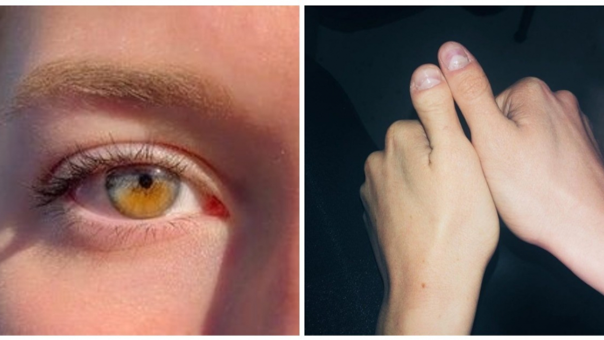 Ces 20 personnes qui ont des traits physiques qui les rendent uniques